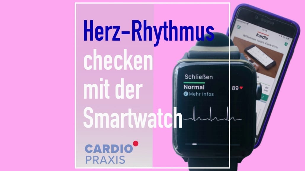 EKG mit Smartphone - KardiaBand von AliveCor | Cardiopraxis