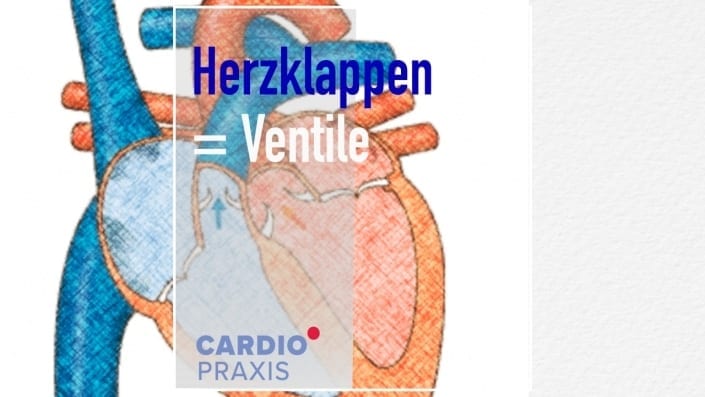 Pulmonalklappe | | Cardiopraxis®