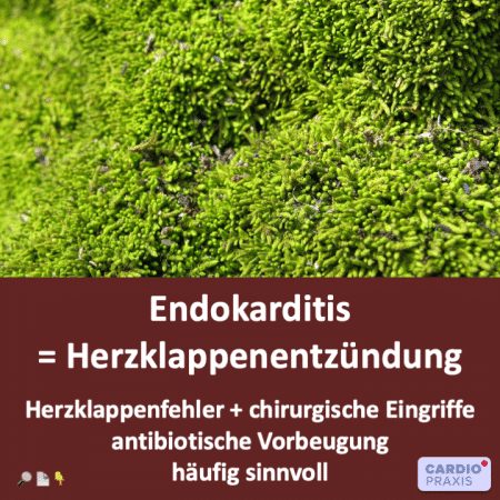Endokarditis: Wenn die Herzinnenhaut erkrankt | | Cardiopraxis®