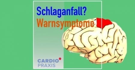 Hirninfarkt | | Cardiopraxis®
