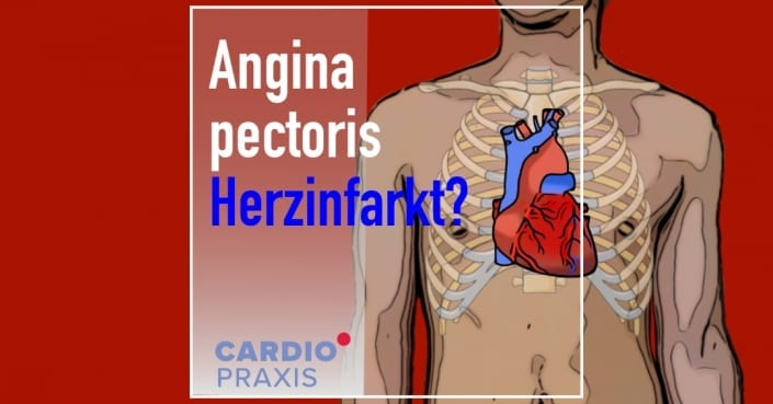 Koronare Herzkrankheit & Herzinfarkt 3 | | Cardiopraxis