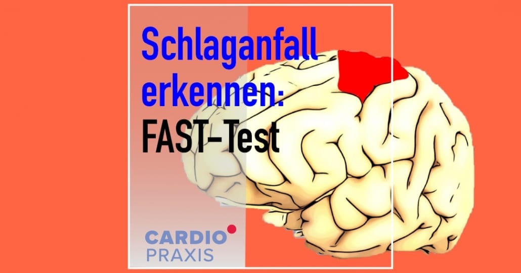 FAST-Test | | Cardiopraxis®