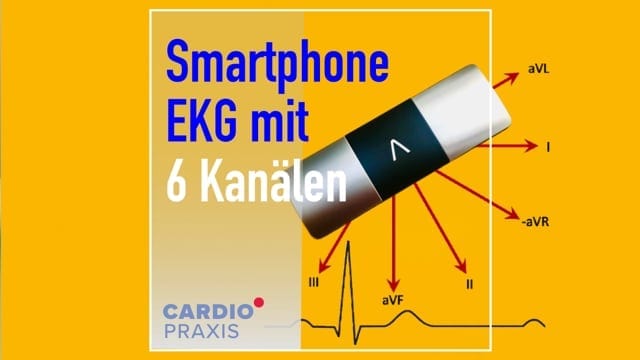 AliveCor KardiaMobile 6L – EKG mit 6 EKG-Ableitungen - Cardiopraxis